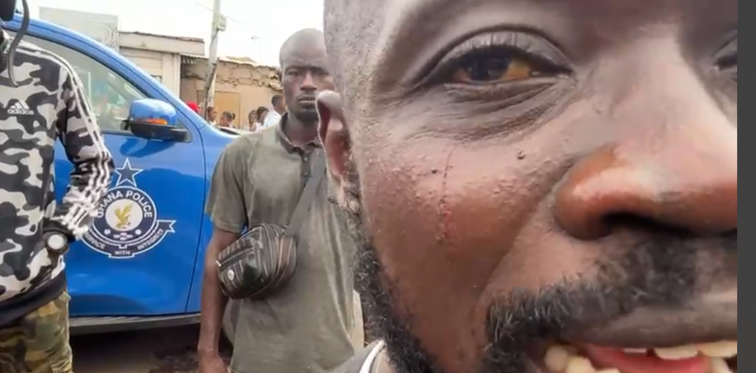 Ablekuma North: GHOne TV journalist slapped by Police officer ...